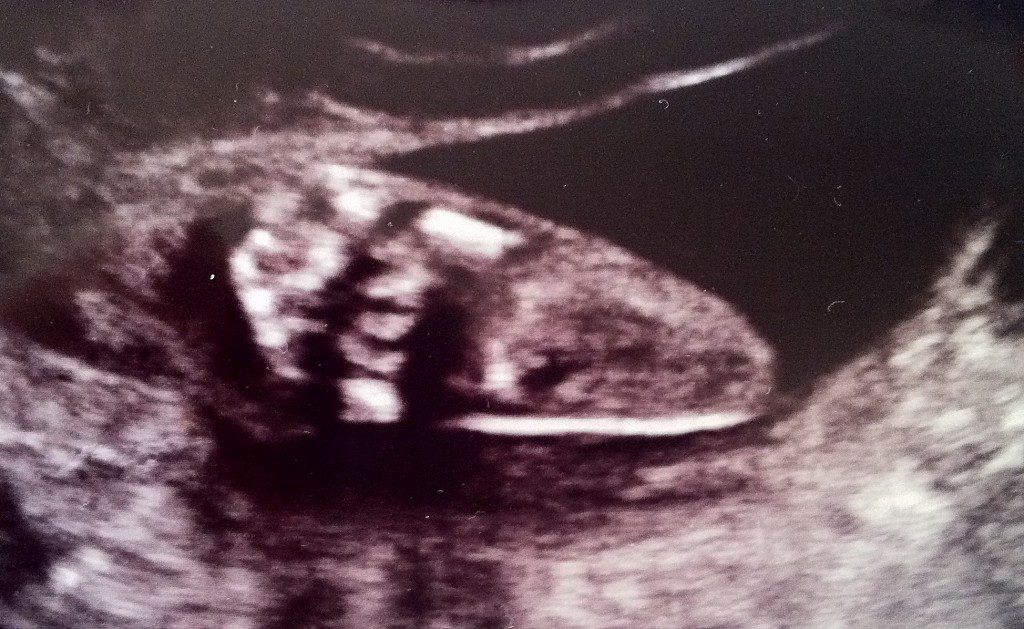 Pregnancy week 22: footprints, and finding out the sex - A Baby on ...